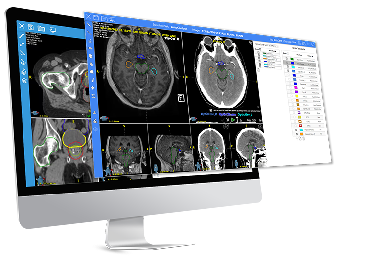 Webinar Autocontour RADFormation – at3w-mk